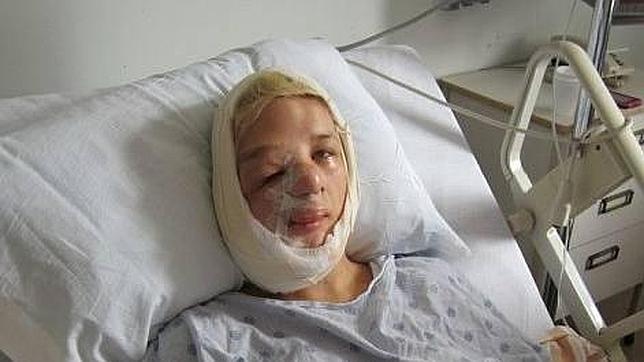 Sarah Atwell, la joven sin rostro, recupera la sonrisa