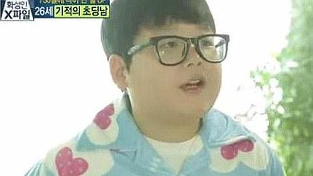 El extraño síndrome que hace que un hombre adulto parezca un niño